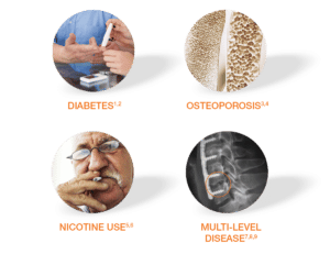 Spinal Devices for Posterior Cervical & Lumbar Fusion | Providence