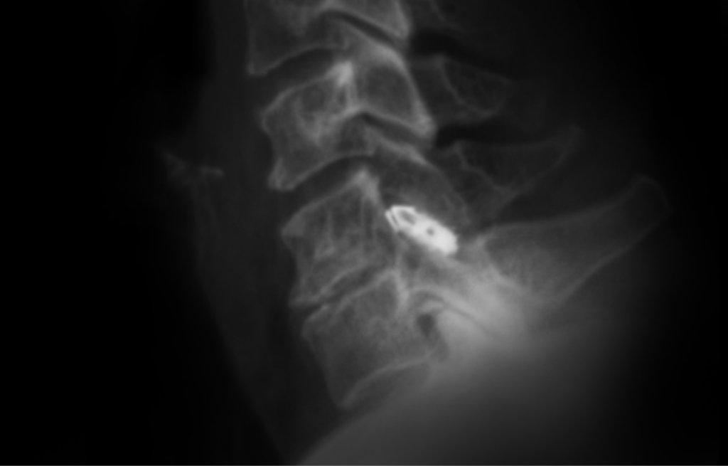 Possible Case Scenarios | Providence