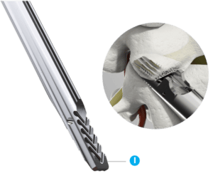 CORUS Spinal System for Posterior Cervical Fusion | Providence