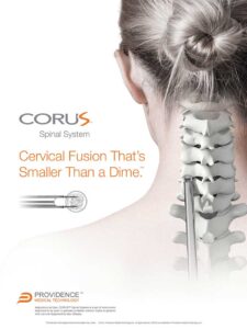 Let's Connect - CORUS - Providence Medical Technology, Inc.
