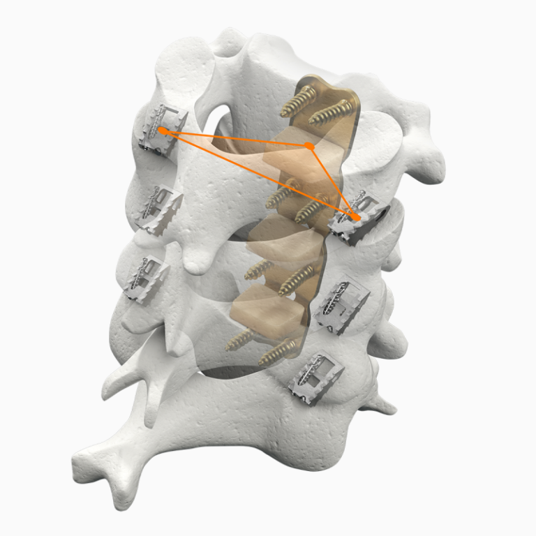 PCSS Quick Study - Providence Medical Technology, Inc.